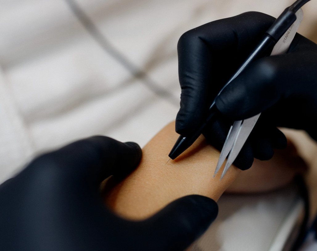 Services - Sugaring Pro à Nice | Épilation électrique et photoépilation ...